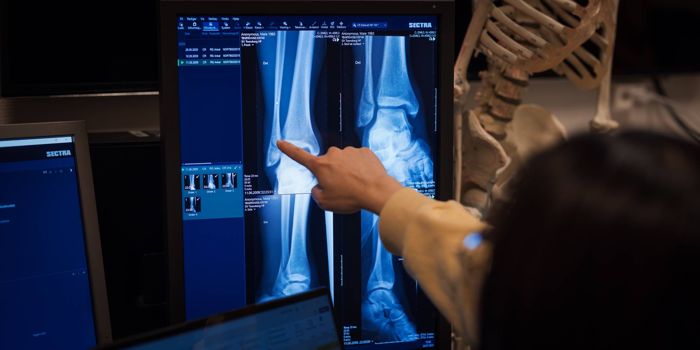 Endelig kan du ta en master i radiografi - OsloMet